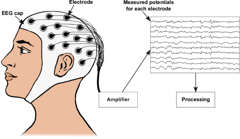 What Common Clinical Tests Do Child Neurologists Rely On? - Child ...
